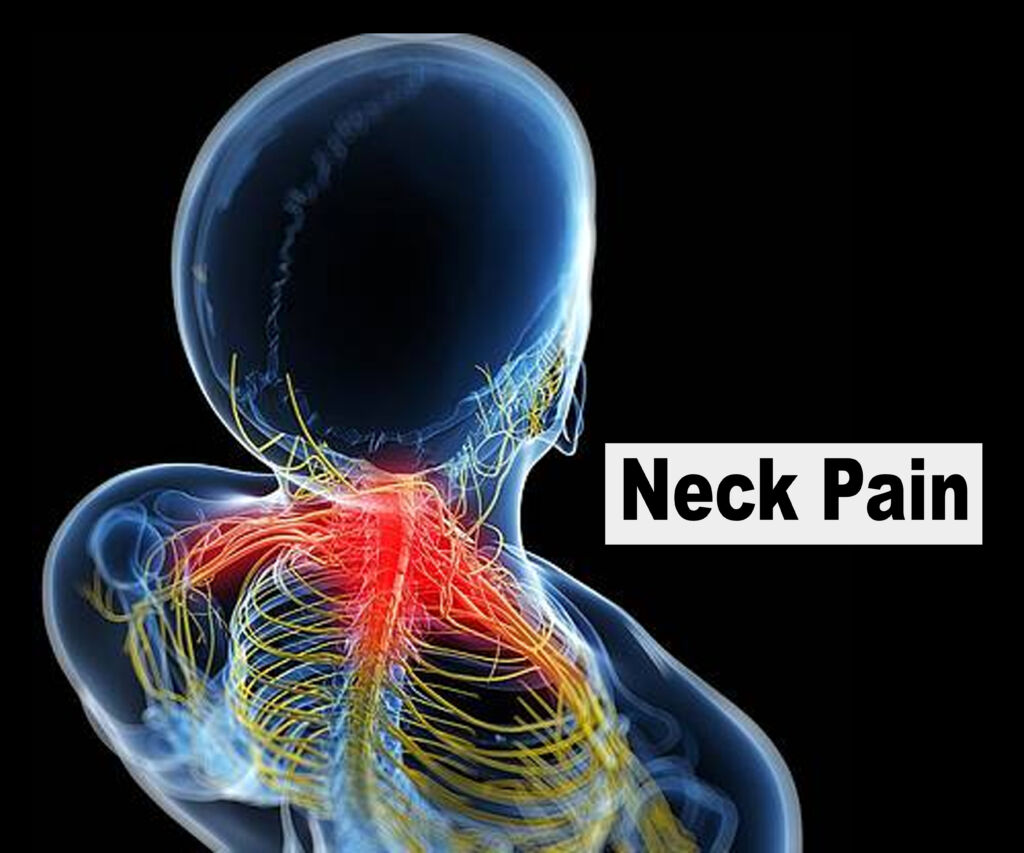 What Are the Long-Term Effects of Untreated Whiplash Injuries?
